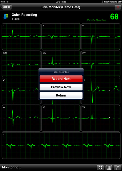 12 channel Wireless Electrocardiogram Resting ECG For iOS ecg Bluetooth ...